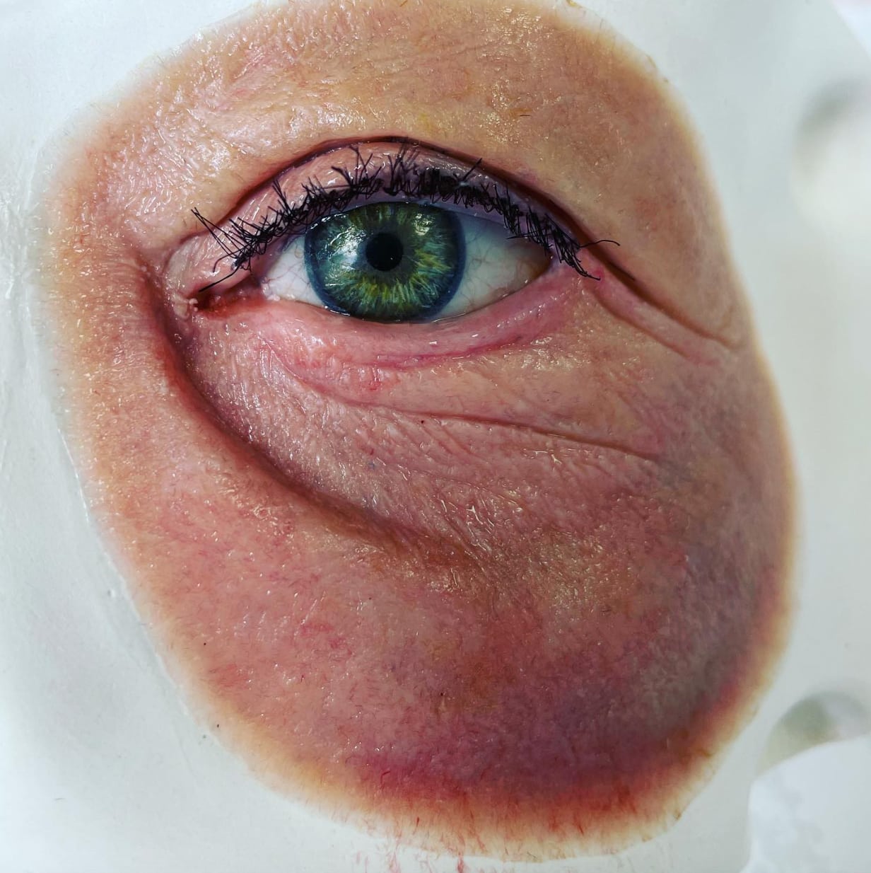 Les épithèses - Corasso